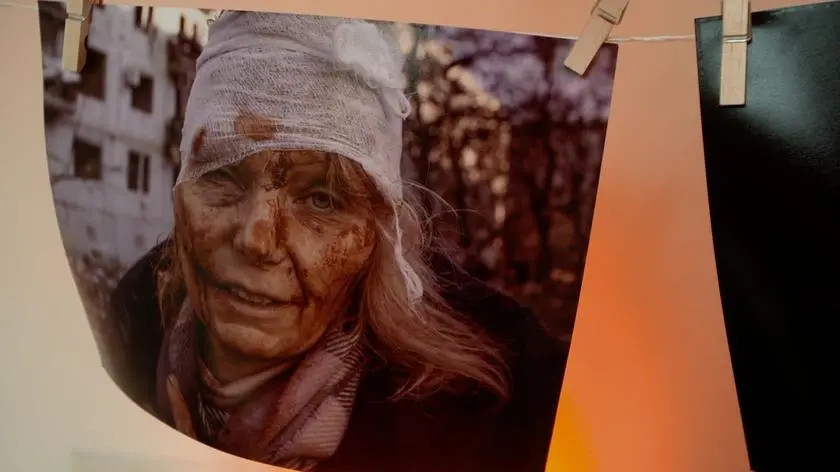 Wojna w Ukrainie oczami jej ofiar. Reportaż Małgorzaty Prochal | TVN24